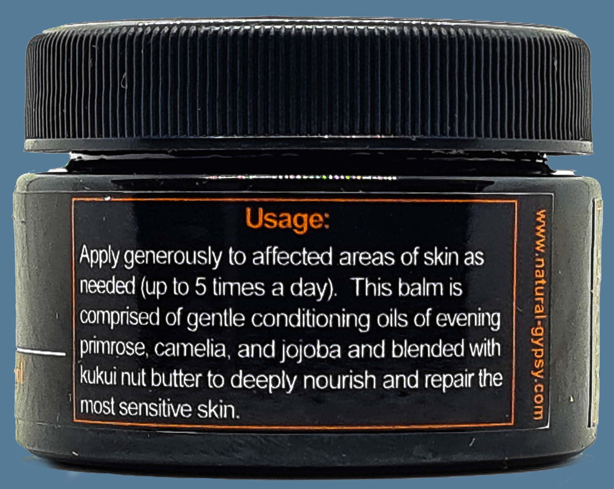 Dry Eczema Balm – Natural Gypsy